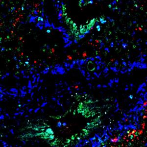 Newfound Cell Defense System Features Toxin-Isolating ‘Sponges’ | NYU ...